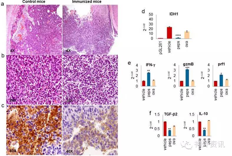 IDH-R132H突变是低级别胶质瘤免疫治疗的新靶点 - 好大夫在线