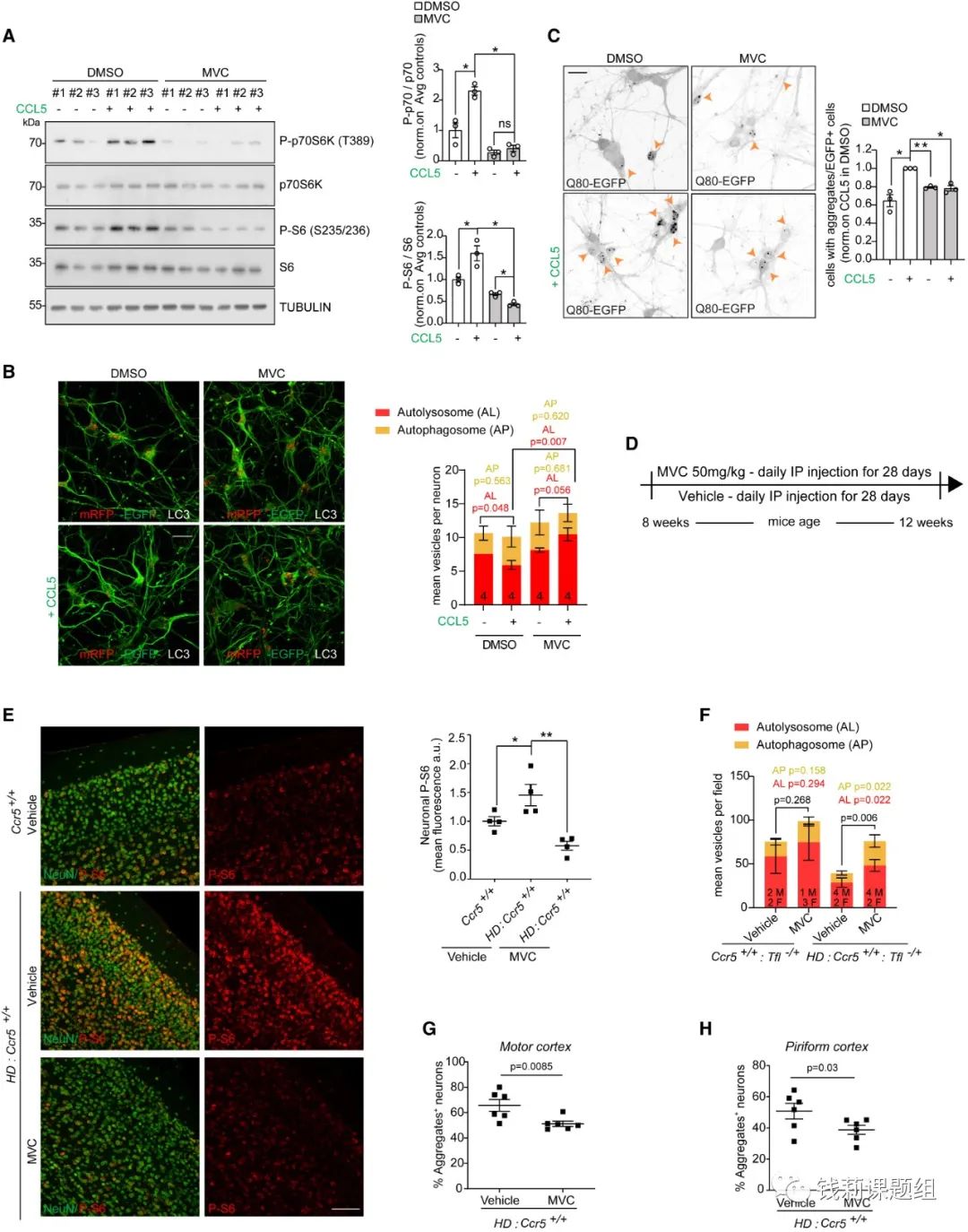 小胶质细胞-神经元（CCR5）信号调节神经退行性变中的自噬 - 好大夫在线