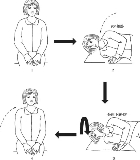 Gufoni手法复位治疗水平半规管耳石症1例_耳石症_耳石症治疗方式 - 好大夫在线