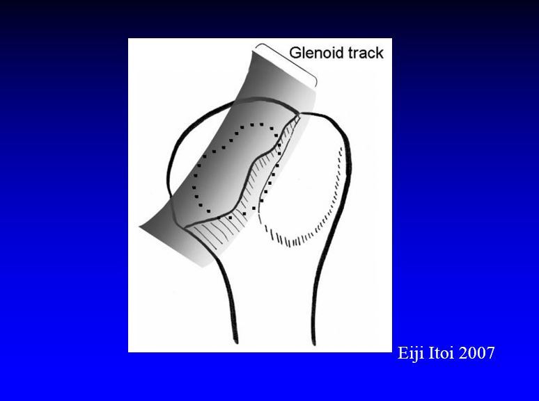 肩胛盂轨迹glenoid track概念是怎么提出来的？ - 好大夫在线
