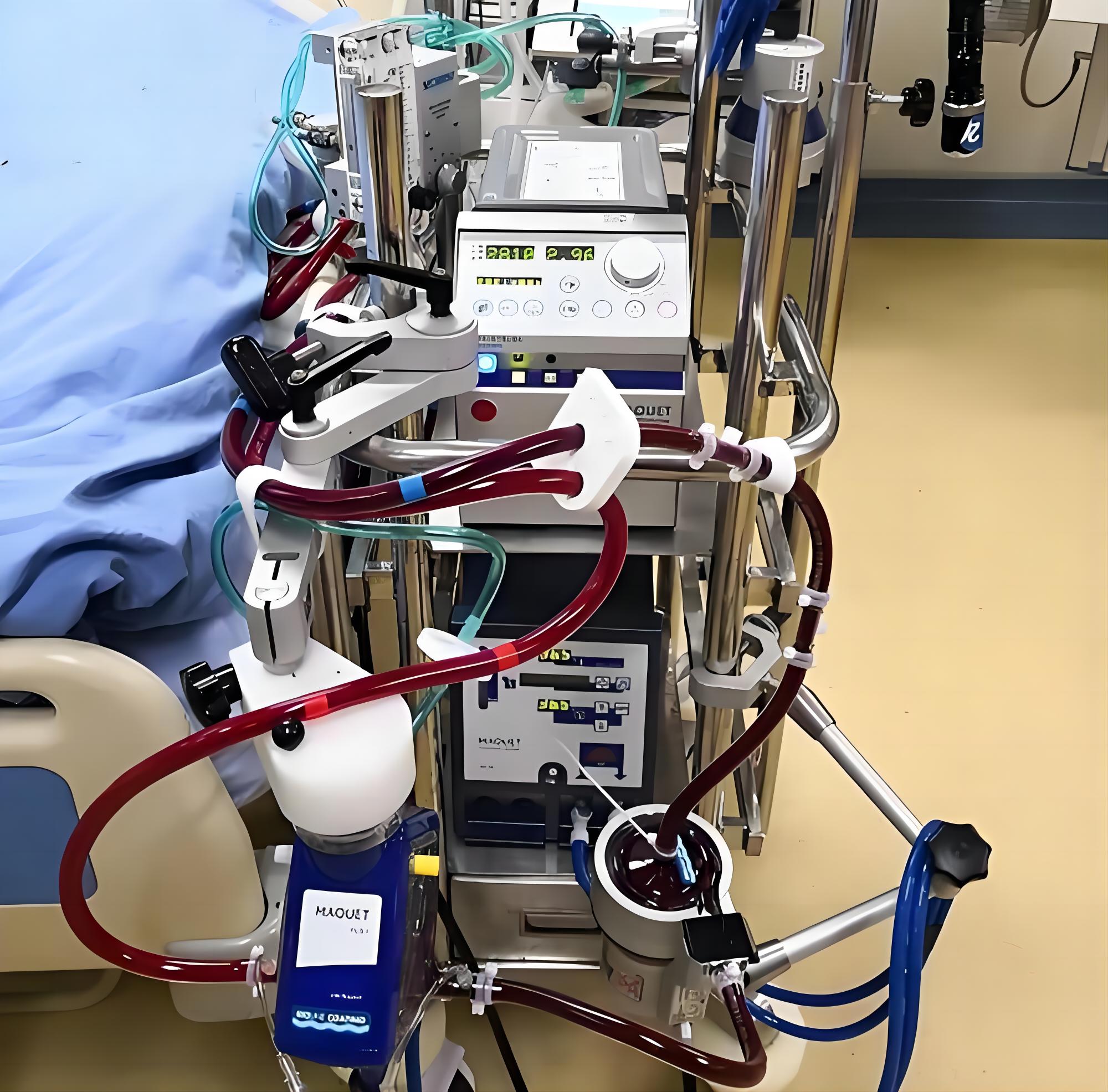 生命的“体外心脏“：ECMO技术如何重绘生死边界？_心衰_治疗方式_日常注意事项 - 好大夫在线